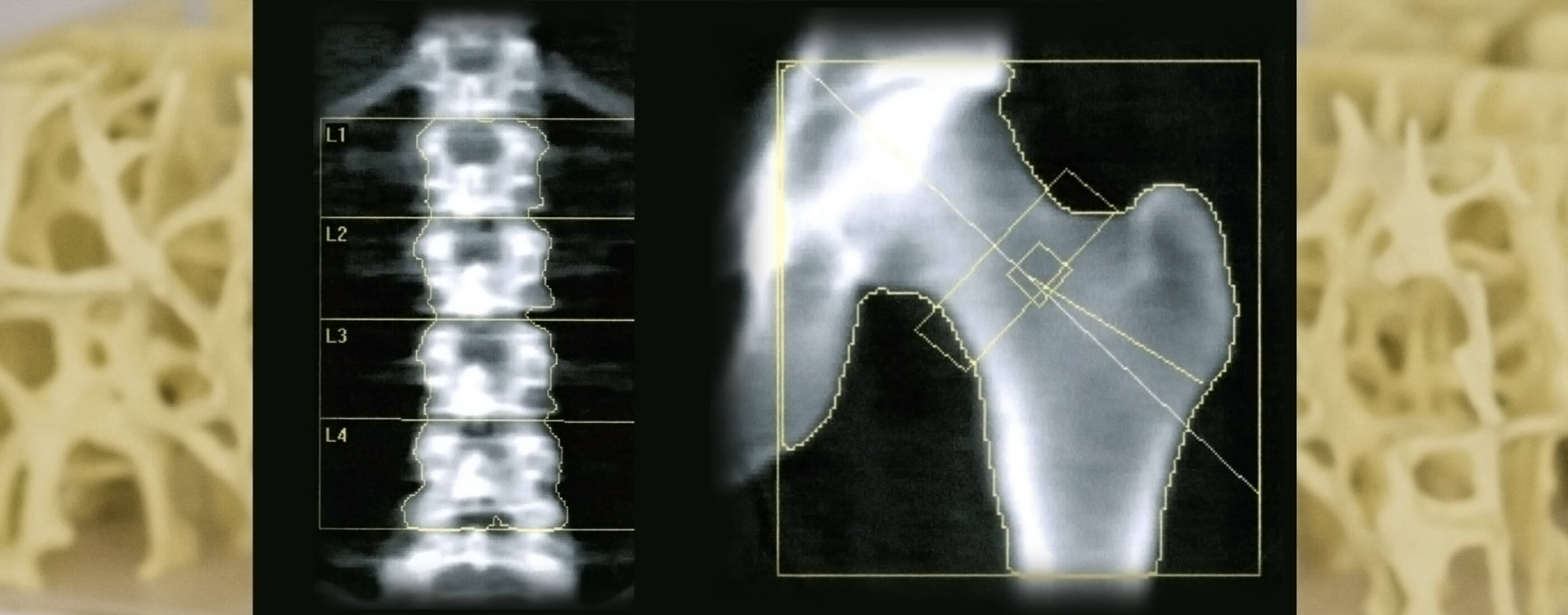 Osteologie / Knochendichtemessung | ORTHOPÄDIEhoch4, Augsburg